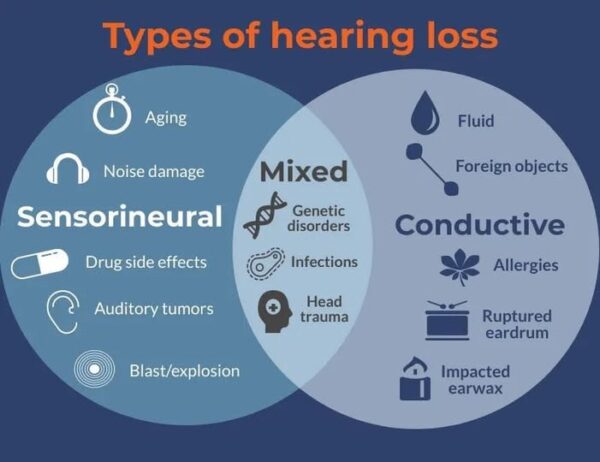 Types of Hearing Loss - Your Reliable Hearing Aids Partner